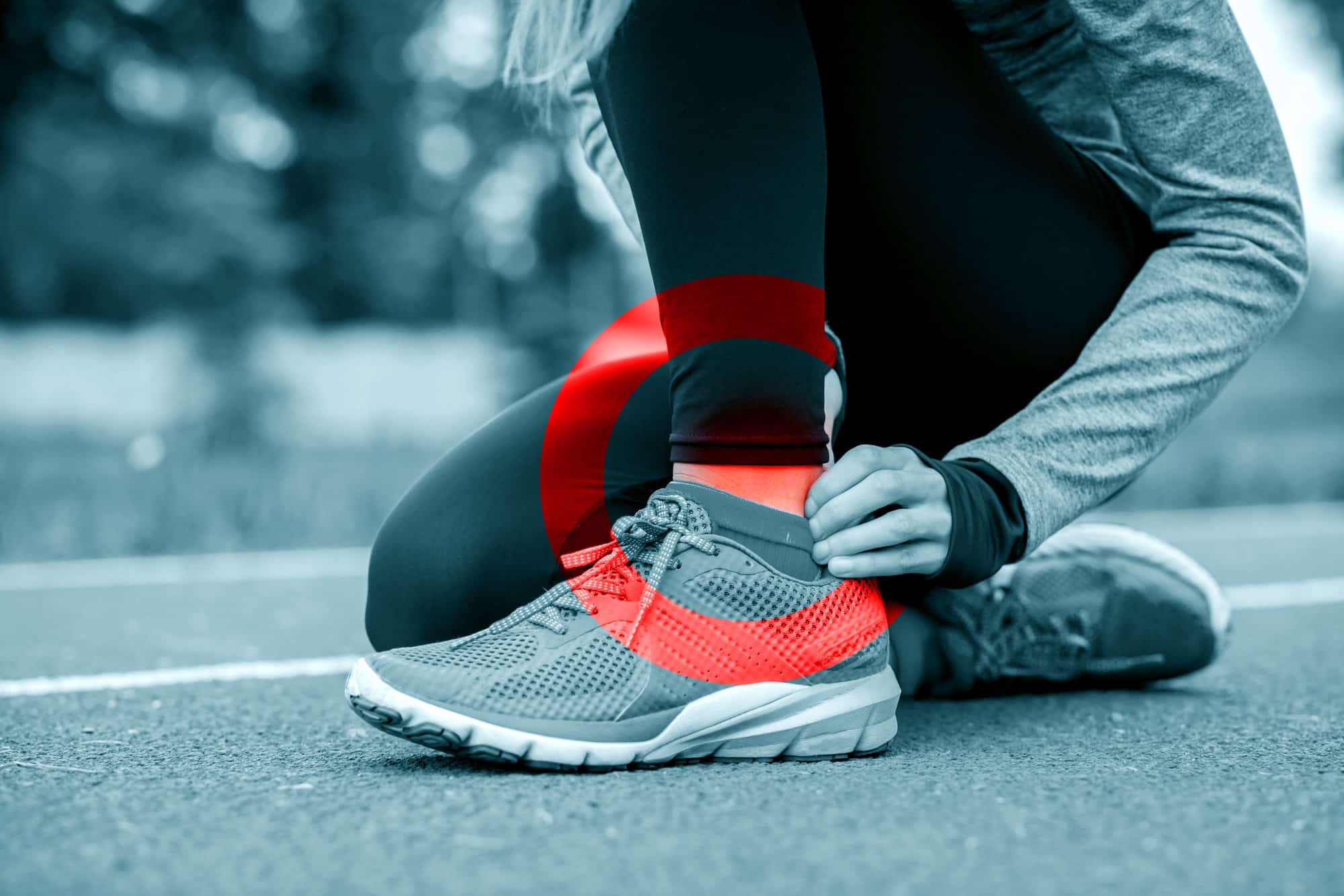 What Is The Difference Between A Muscle Sprain & Strain?